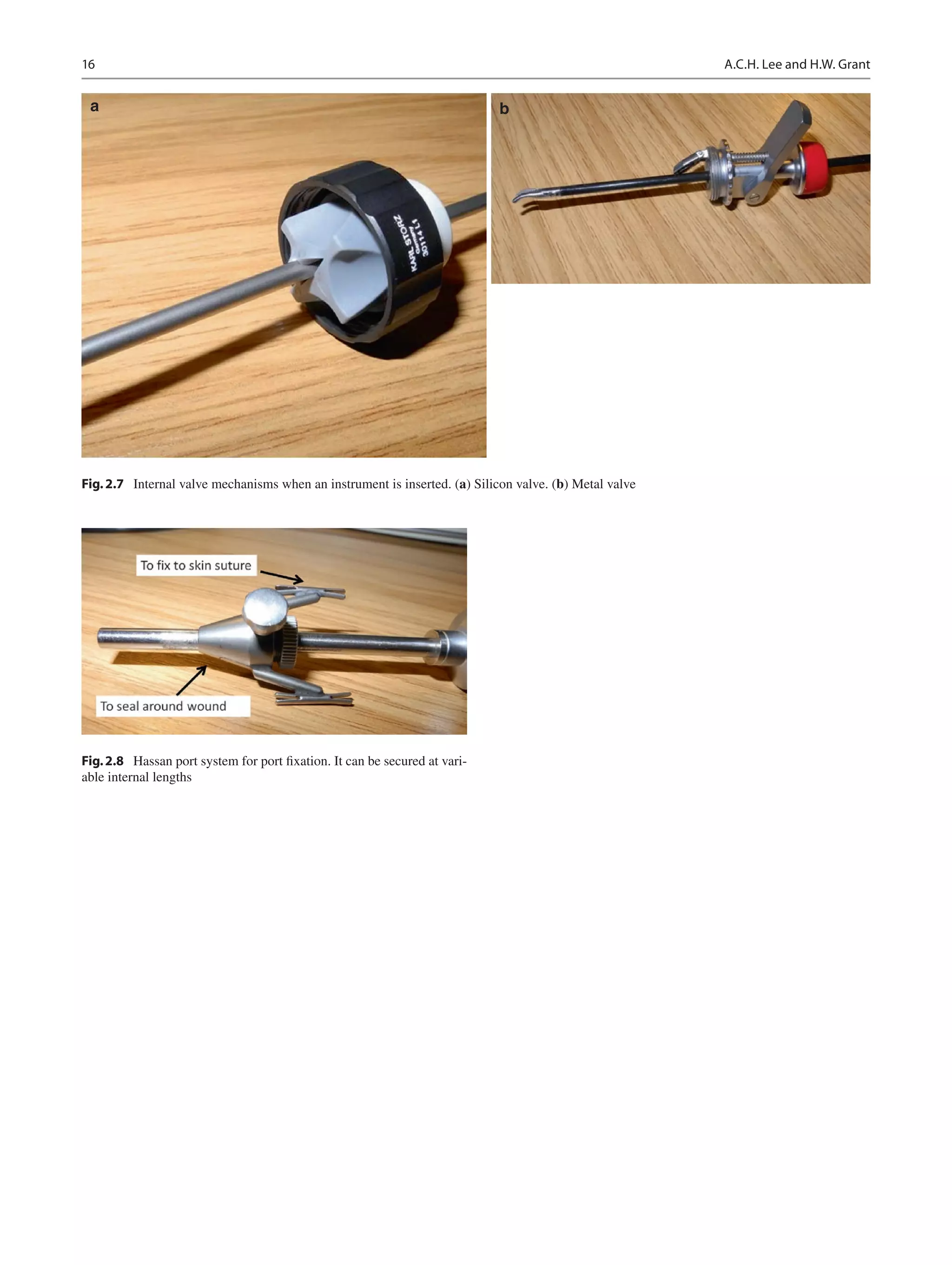 Color atlas of pediatric anatomy, laparoscopy, | PDF