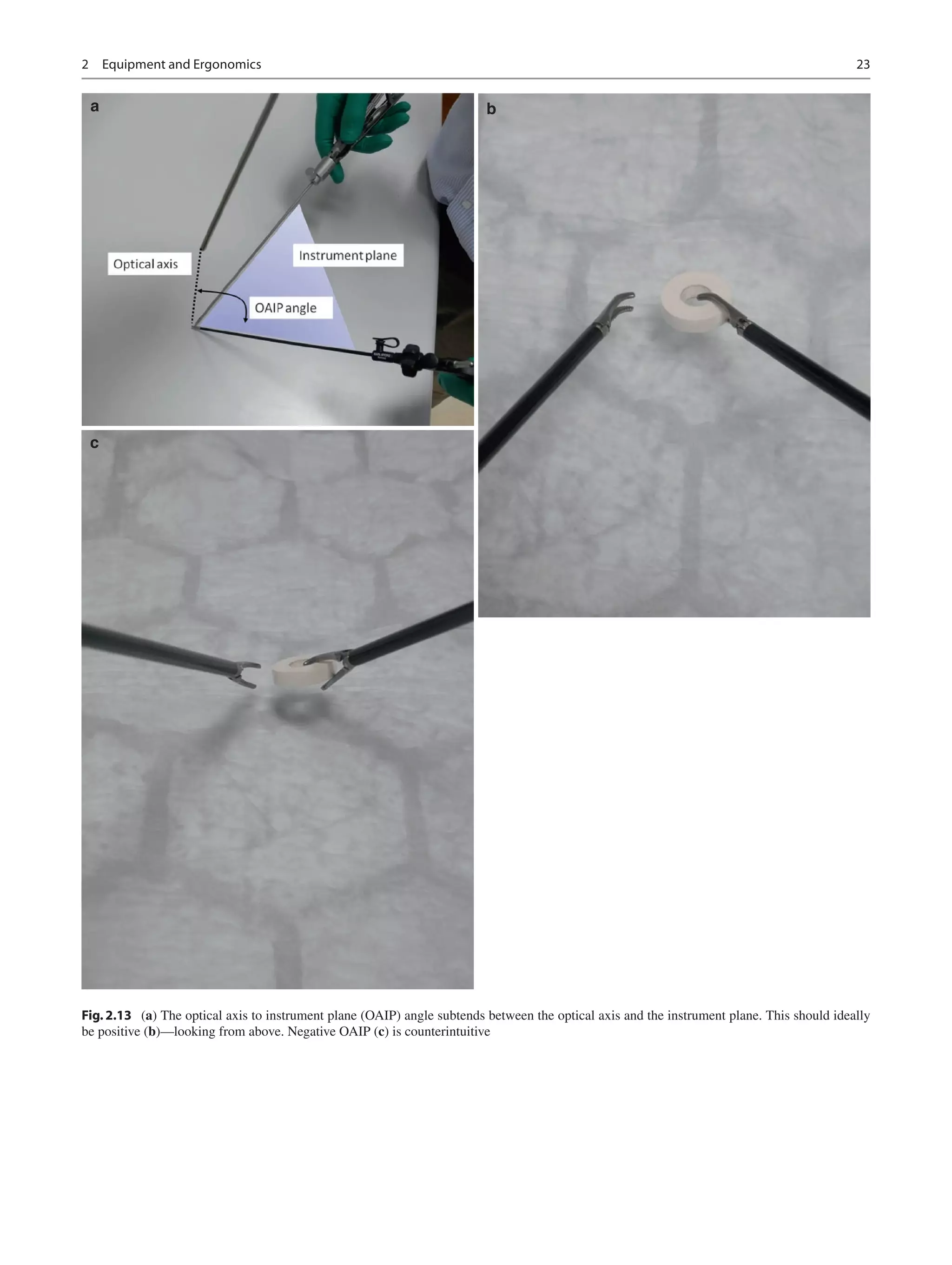 Color atlas of pediatric anatomy, laparoscopy, | PDF