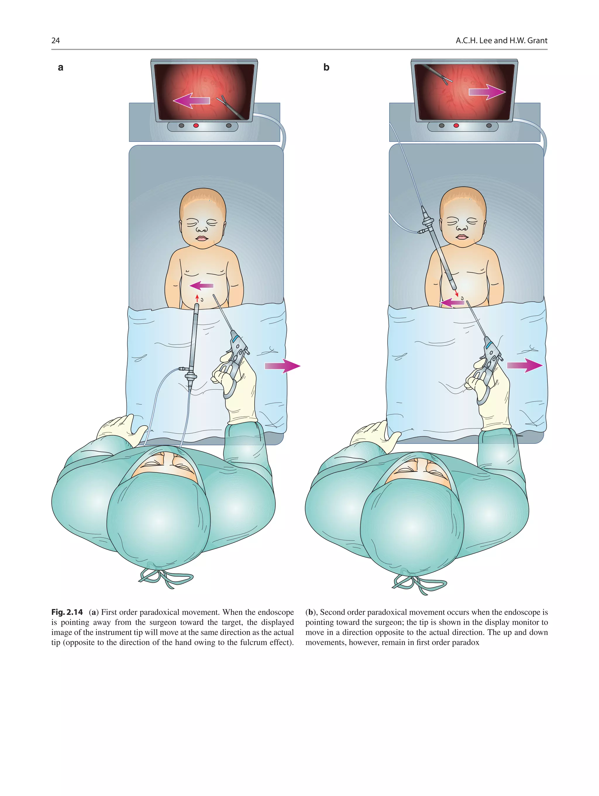 Color atlas of pediatric anatomy, laparoscopy, | PDF