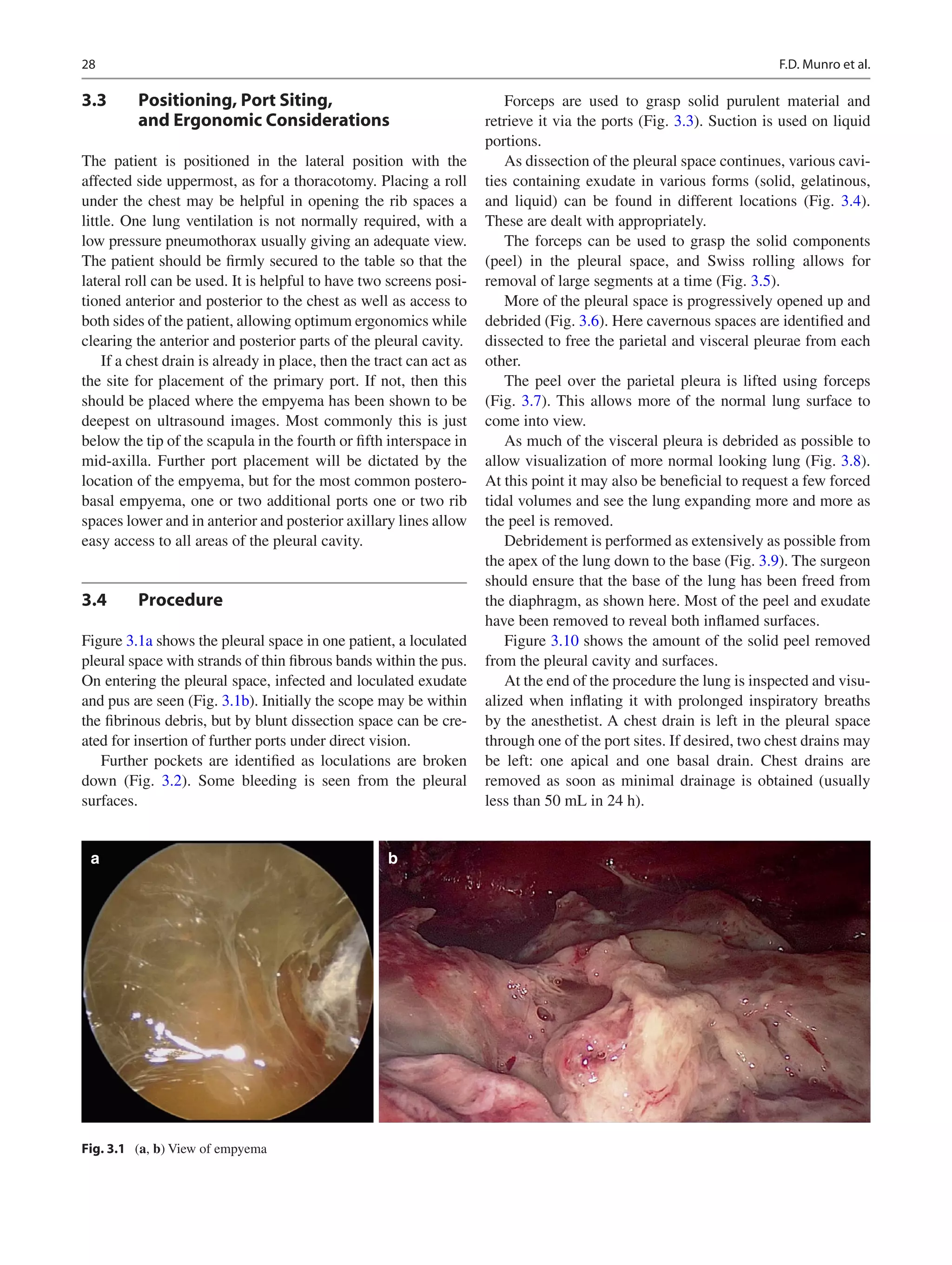 Color atlas of pediatric anatomy, laparoscopy, | PDF