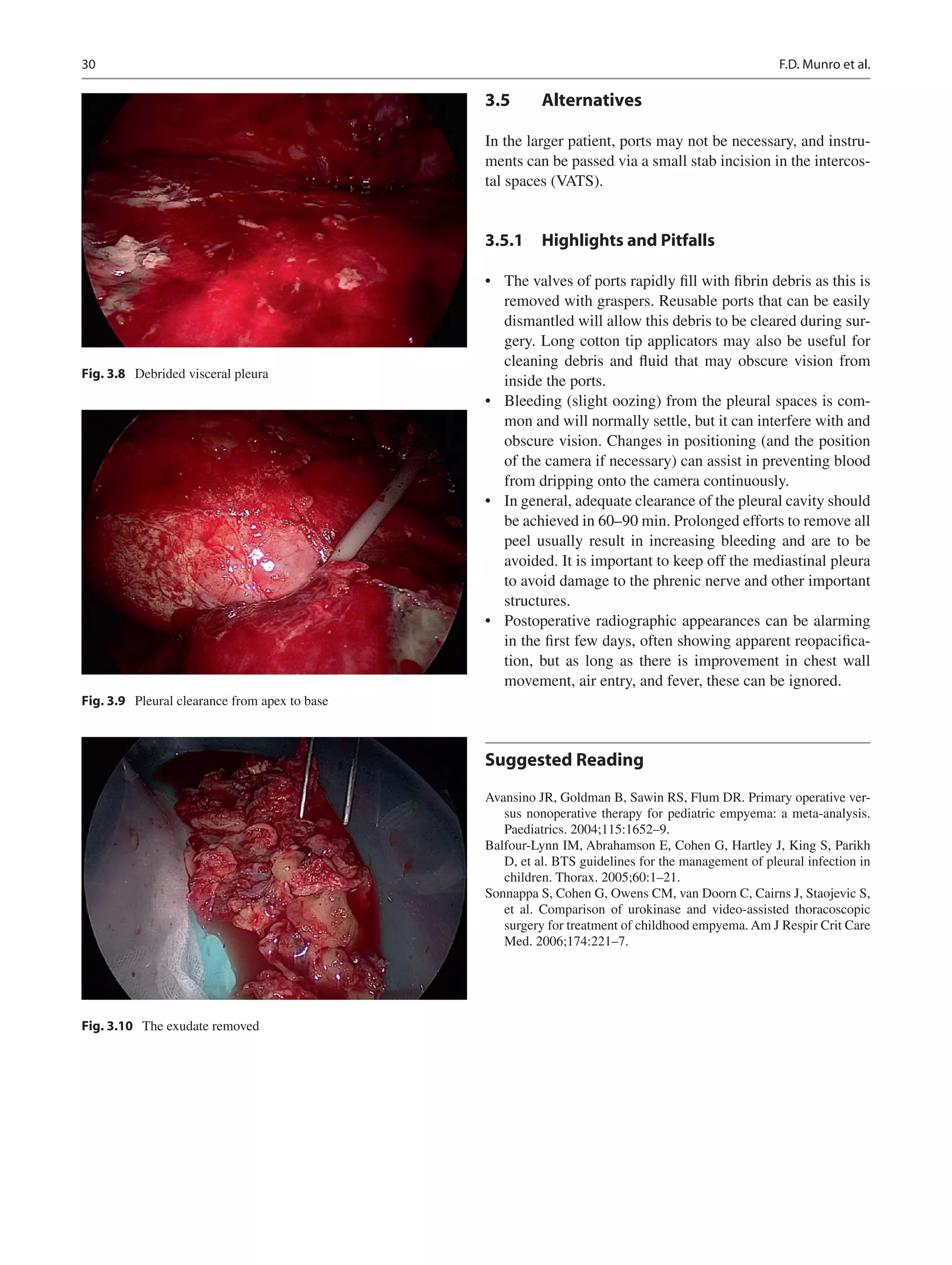 Color atlas of pediatric anatomy, laparoscopy, | PDF
