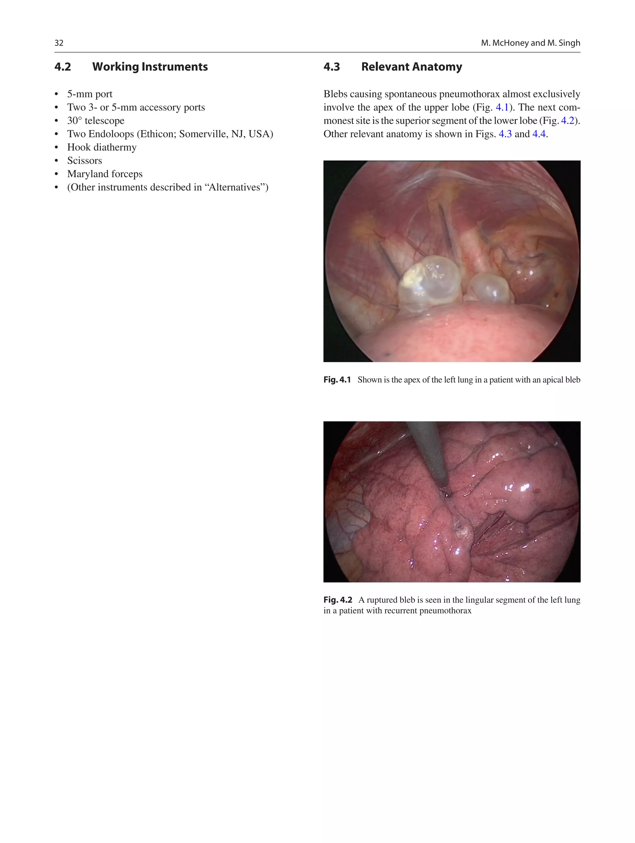 Color atlas of pediatric anatomy, laparoscopy, | PDF