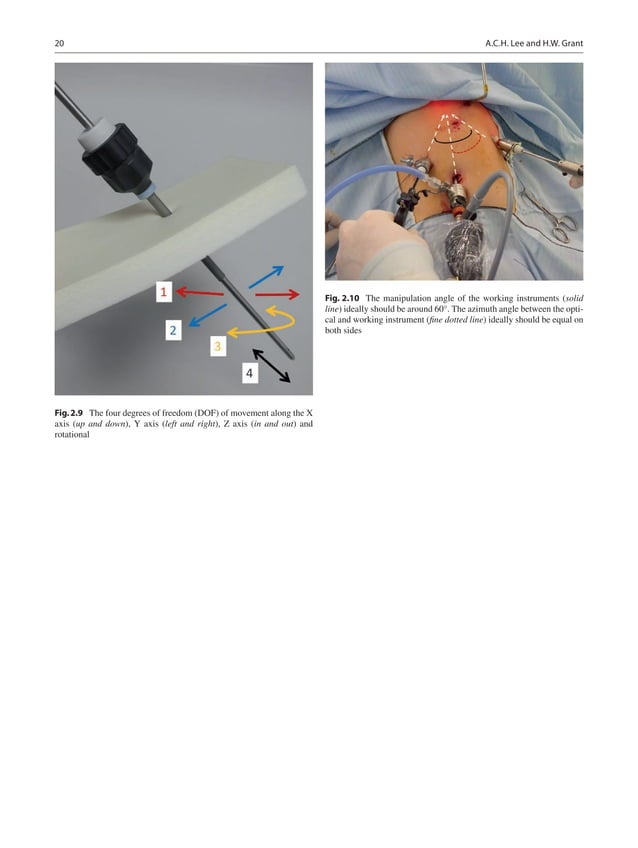 Color atlas of pediatric anatomy, laparoscopy, | PDF