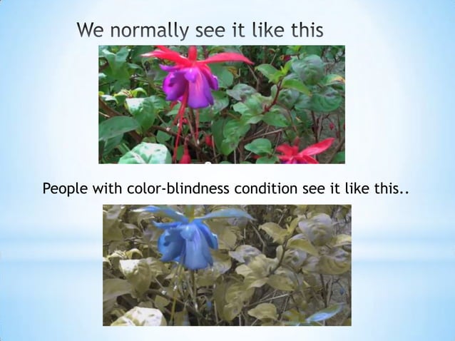 Color blind nocolor-eye anatomy | PPTX | Eye and Vision Conditions ...