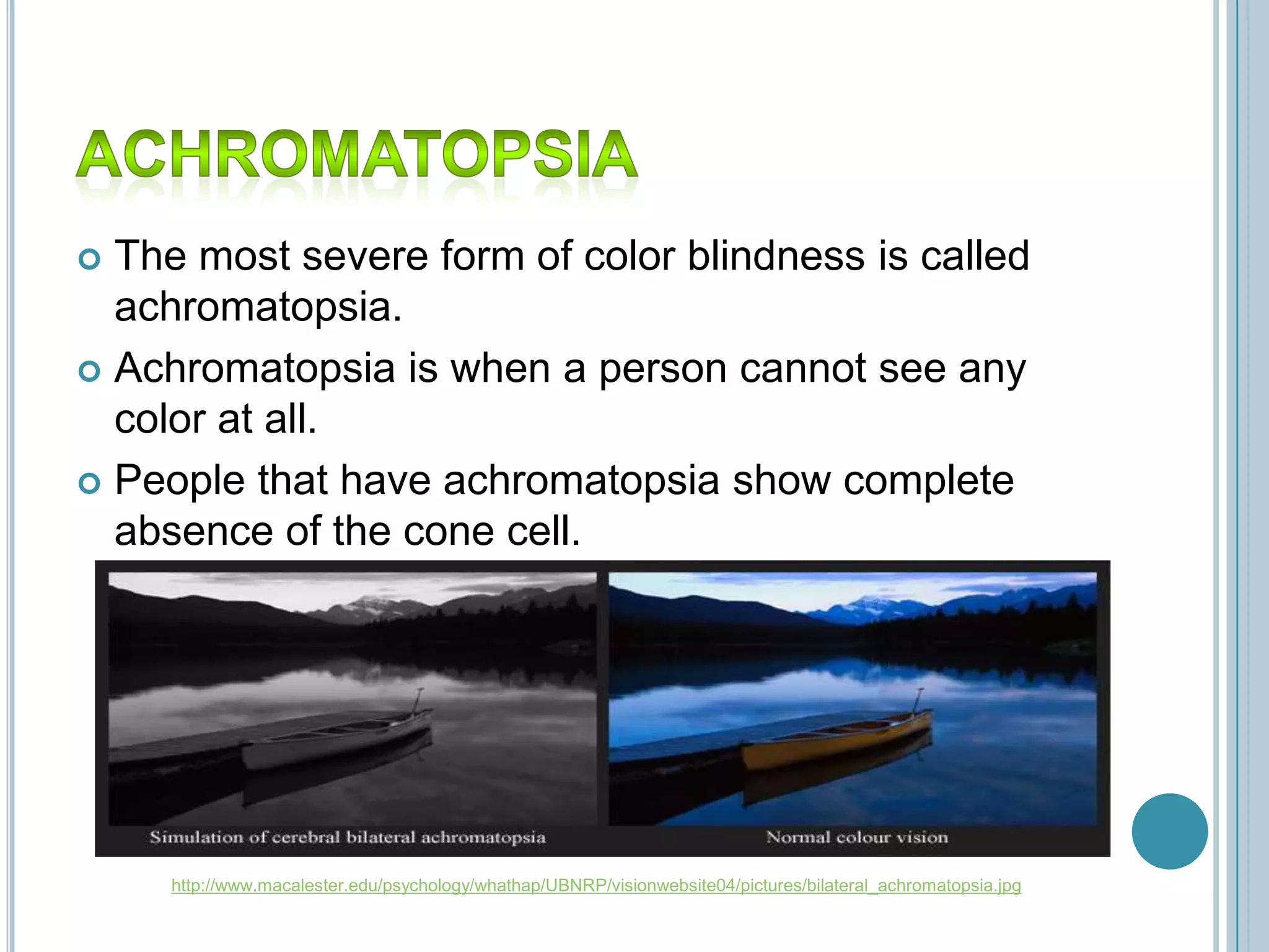 Color Blindness | PPTX