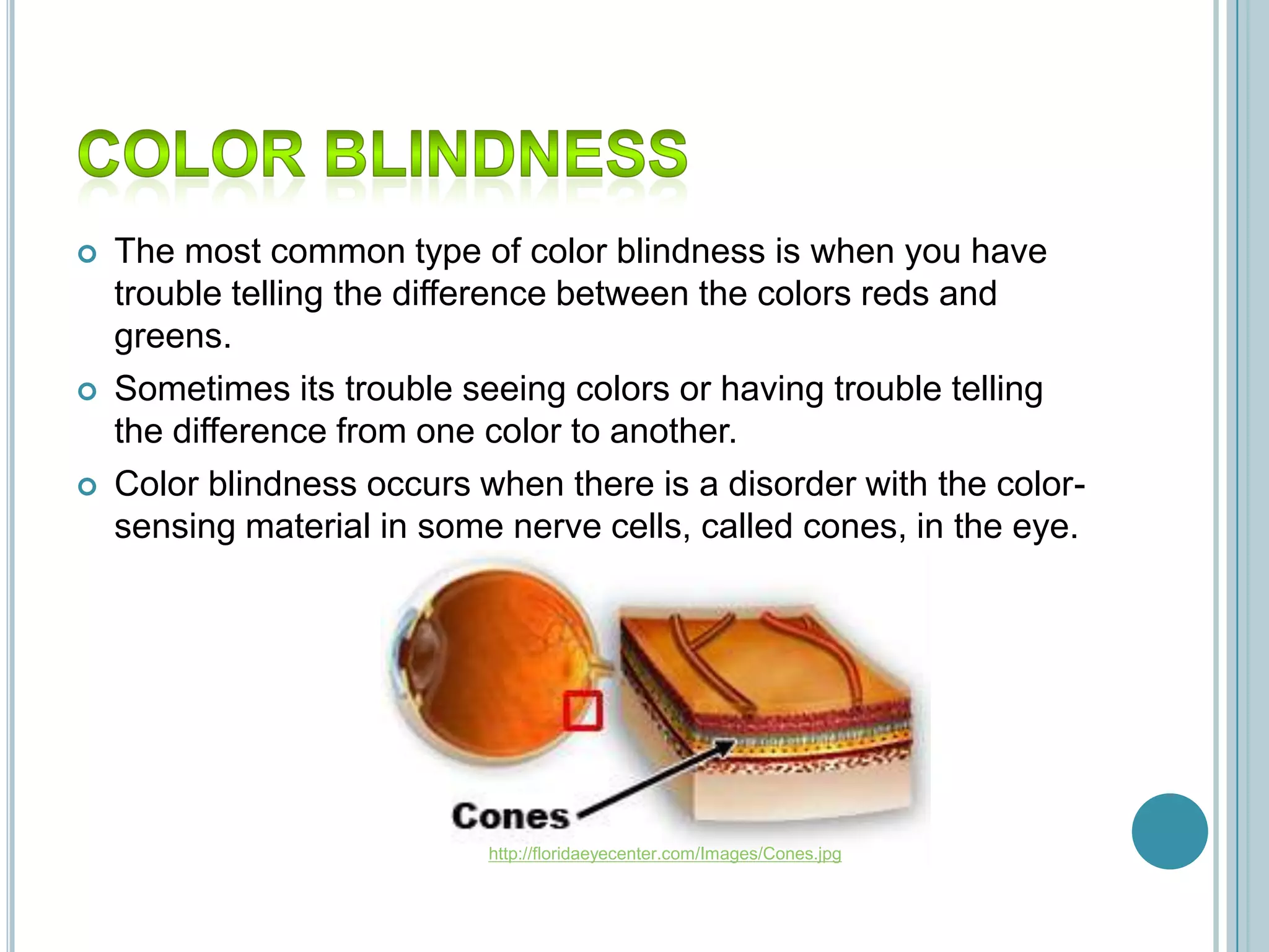 Color Blindness | PPTX