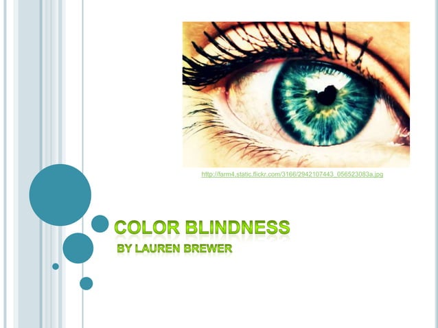 Color Blindness | PPTX