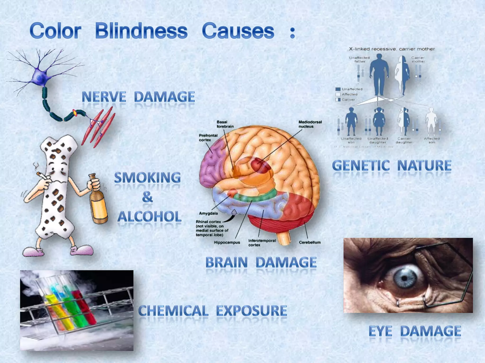 Color blindness | PDF