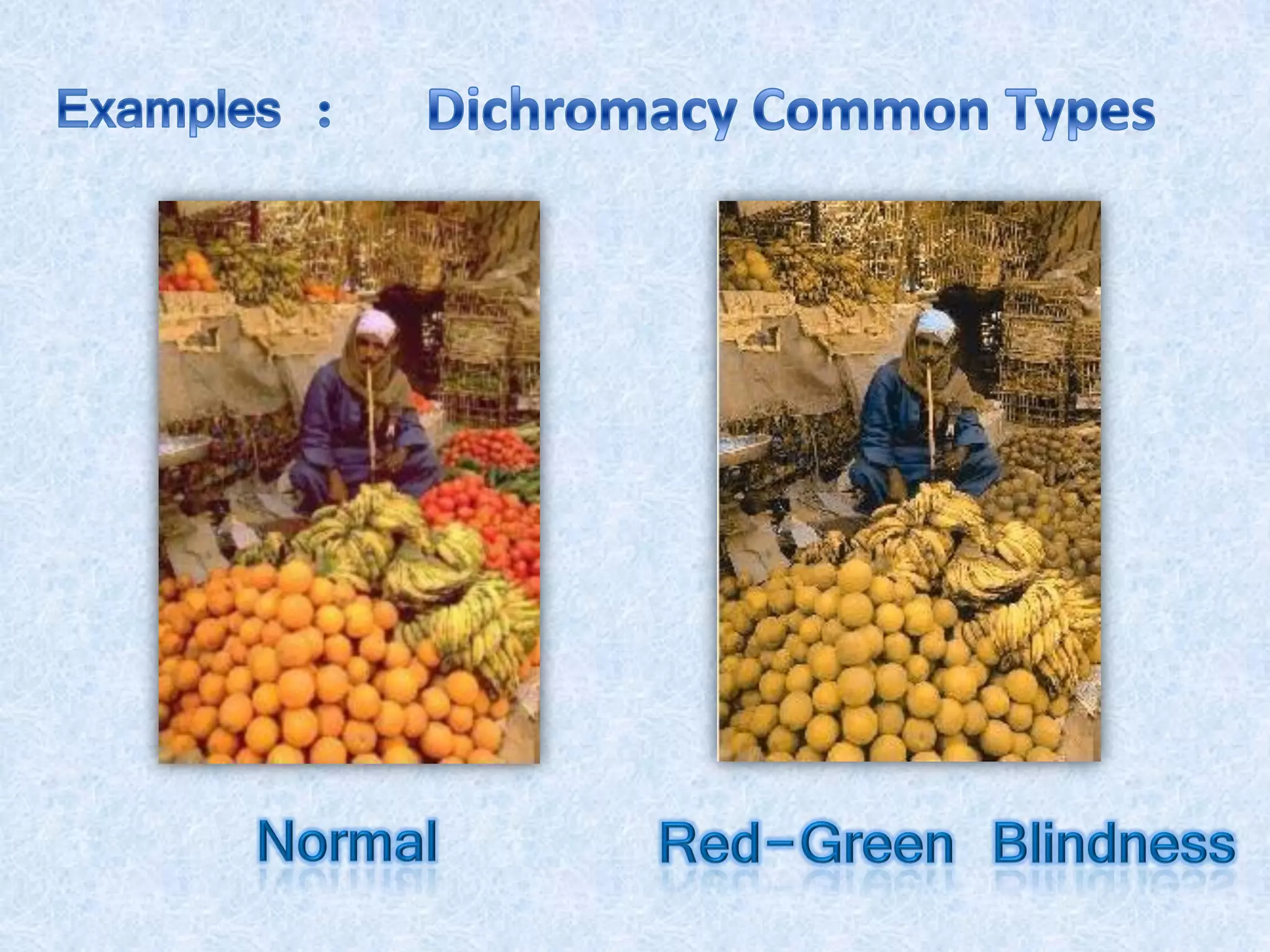 Color blindness | PDF