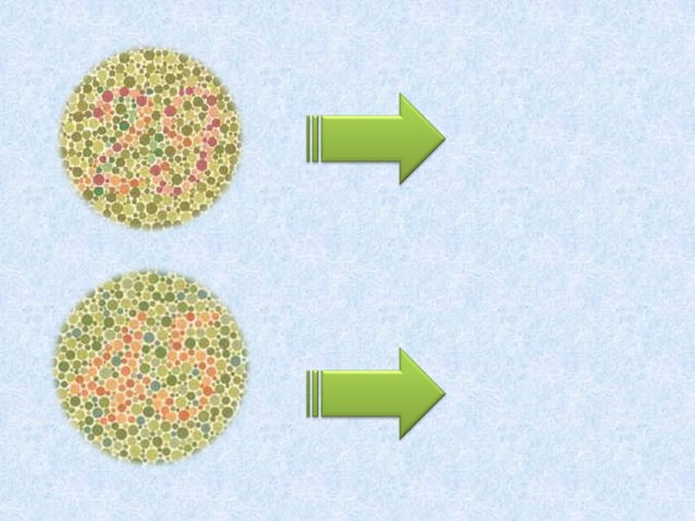 Color blindness | PDF