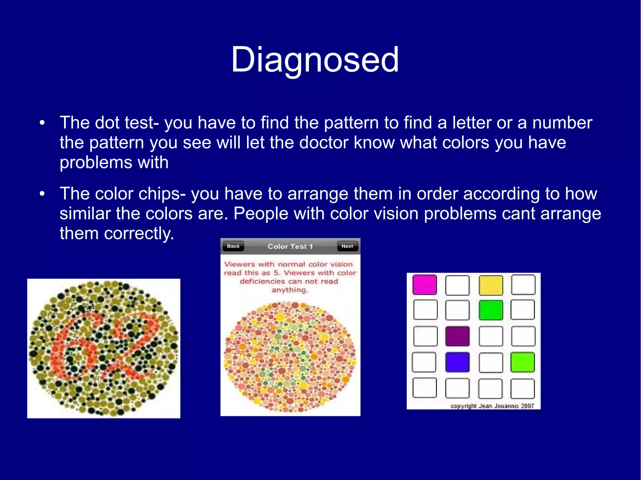 Color blindness | ODP | Eye and Vision Conditions | Diseases and Conditions