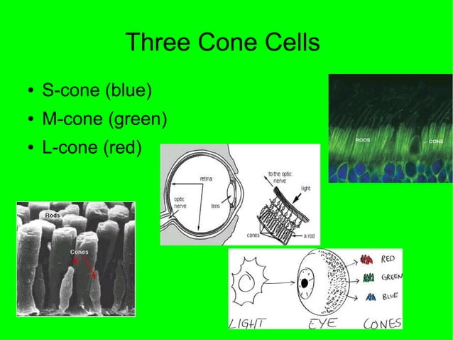 Color blindness | ODP | Eye and Vision Conditions | Diseases and Conditions
