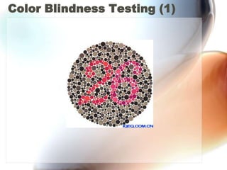 Color Blindness | PPT