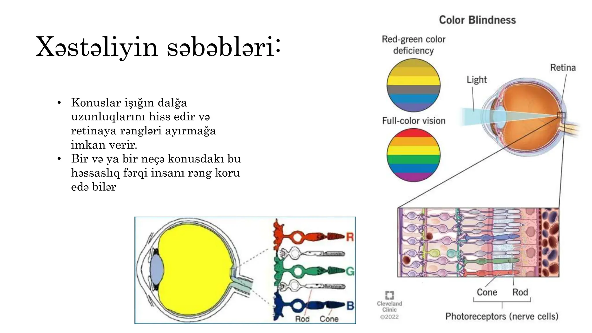 ColorBlindness.Daltonizm.pptx