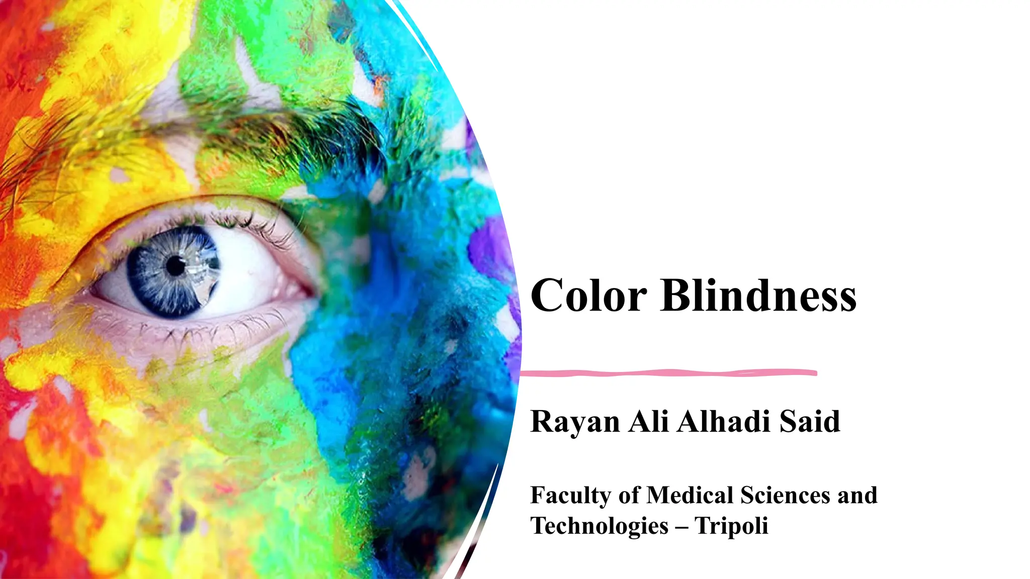 color blindness (color vision deficiency) | PPTX