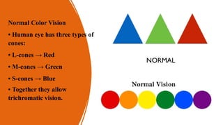 color blindness (color vision deficiency) | PPTX