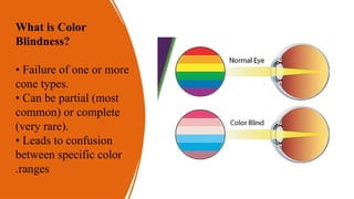 color blindness (color vision deficiency) | PPTX