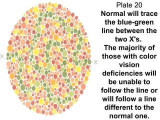 Blue Yellow Color Blindness Test