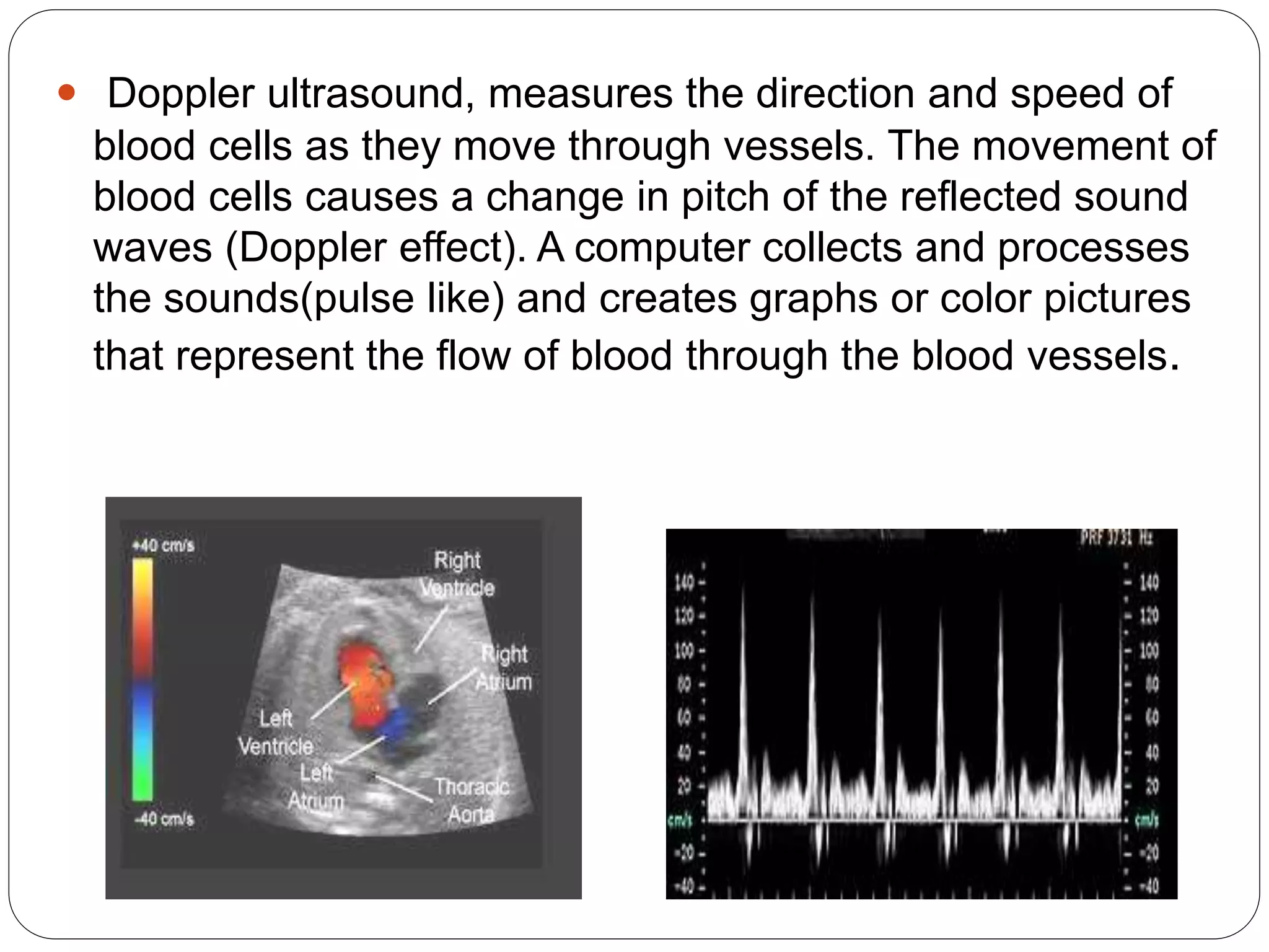 Color doppler | PPTX