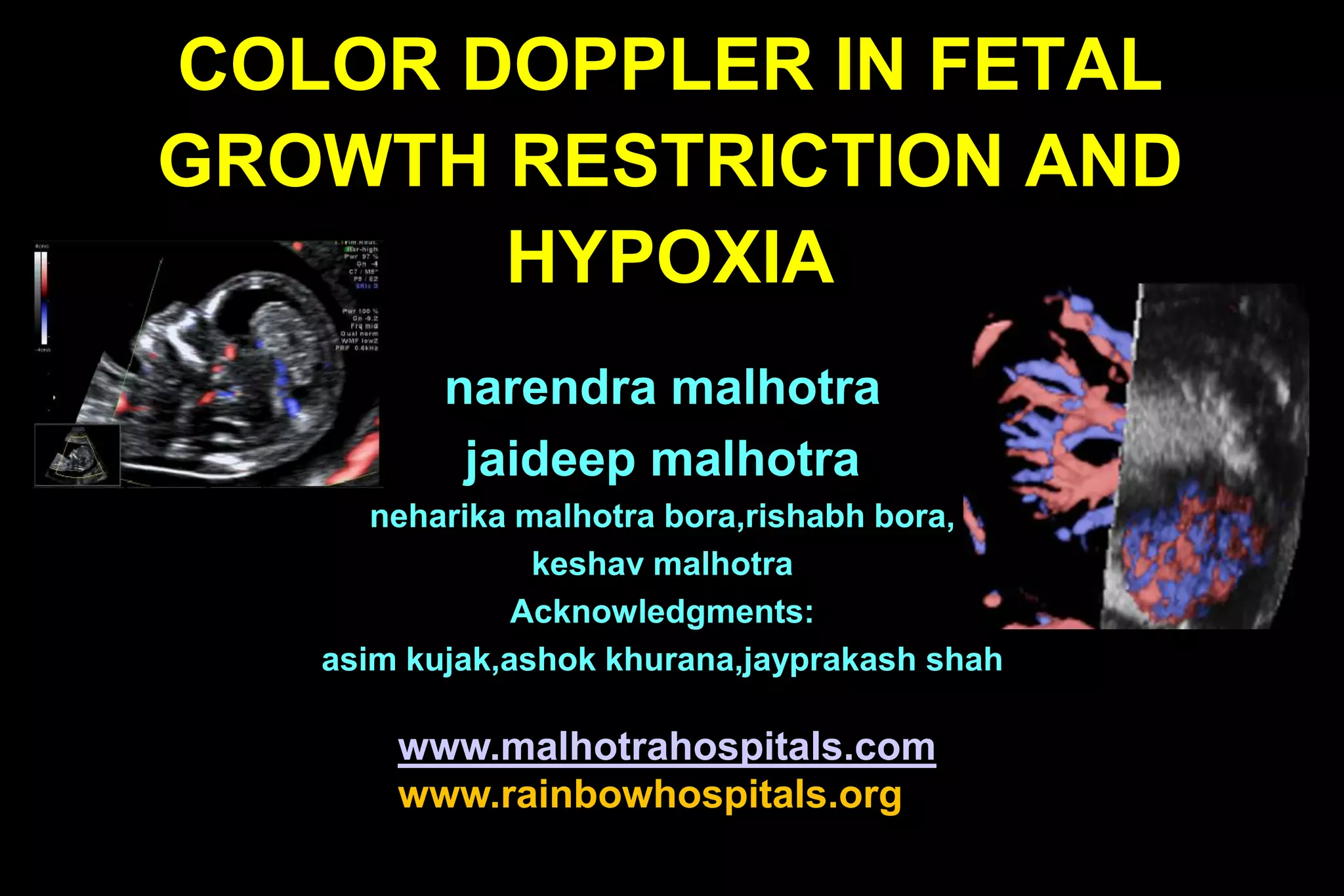 Color doppler in fetal hypoxia | PPTX