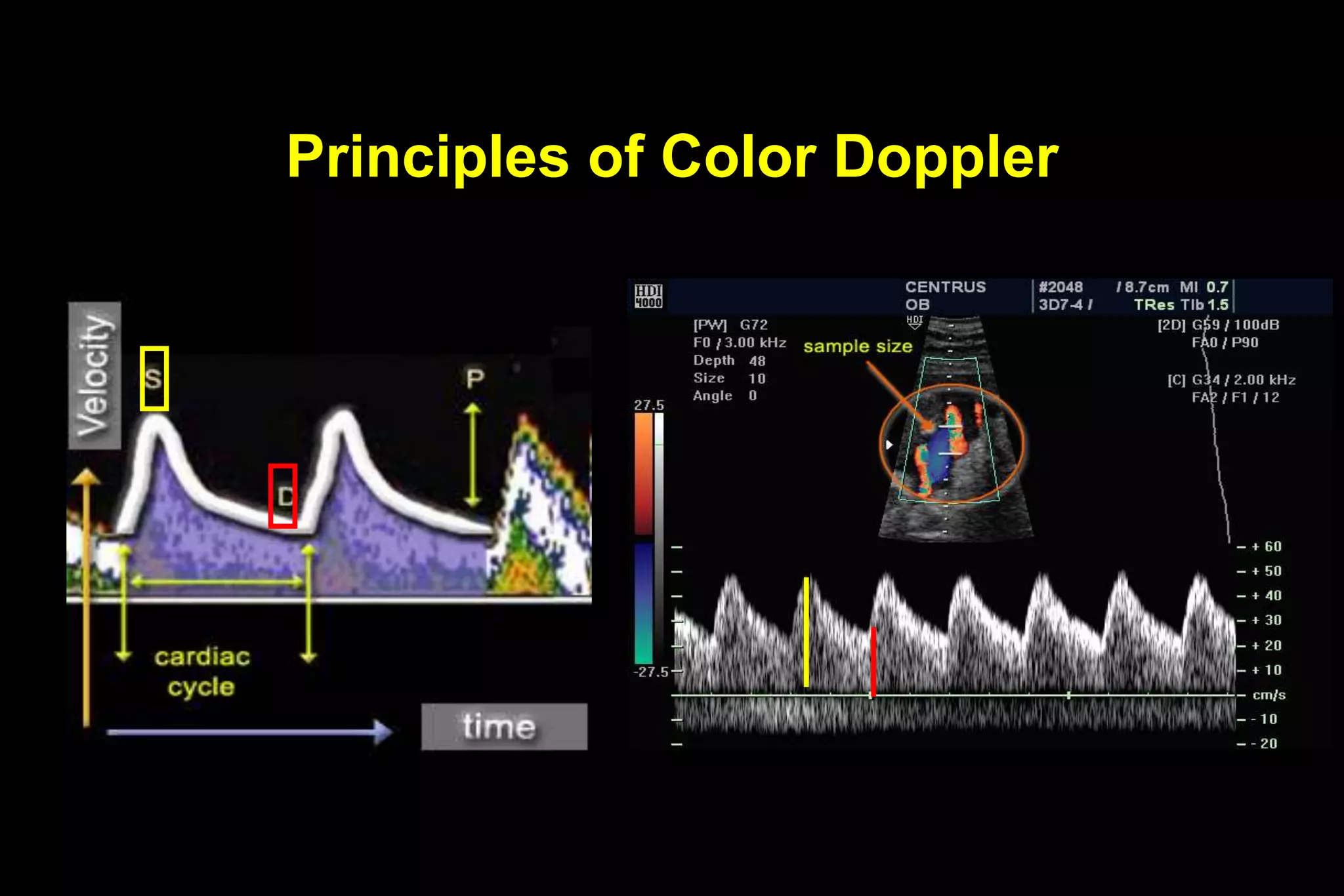 Color doppler in fetal hypoxia | PPTX