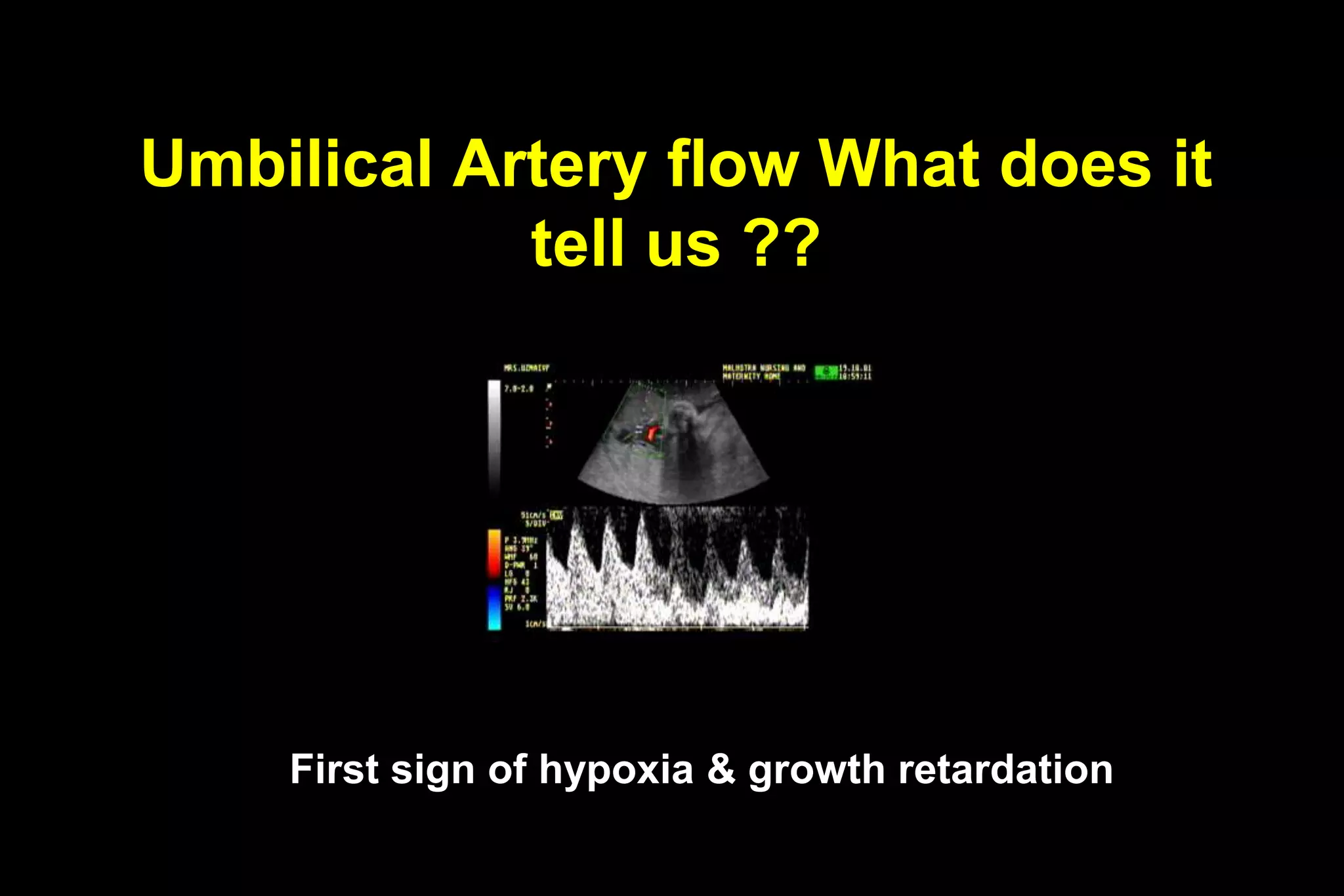 Color doppler in fetal hypoxia | PPTX