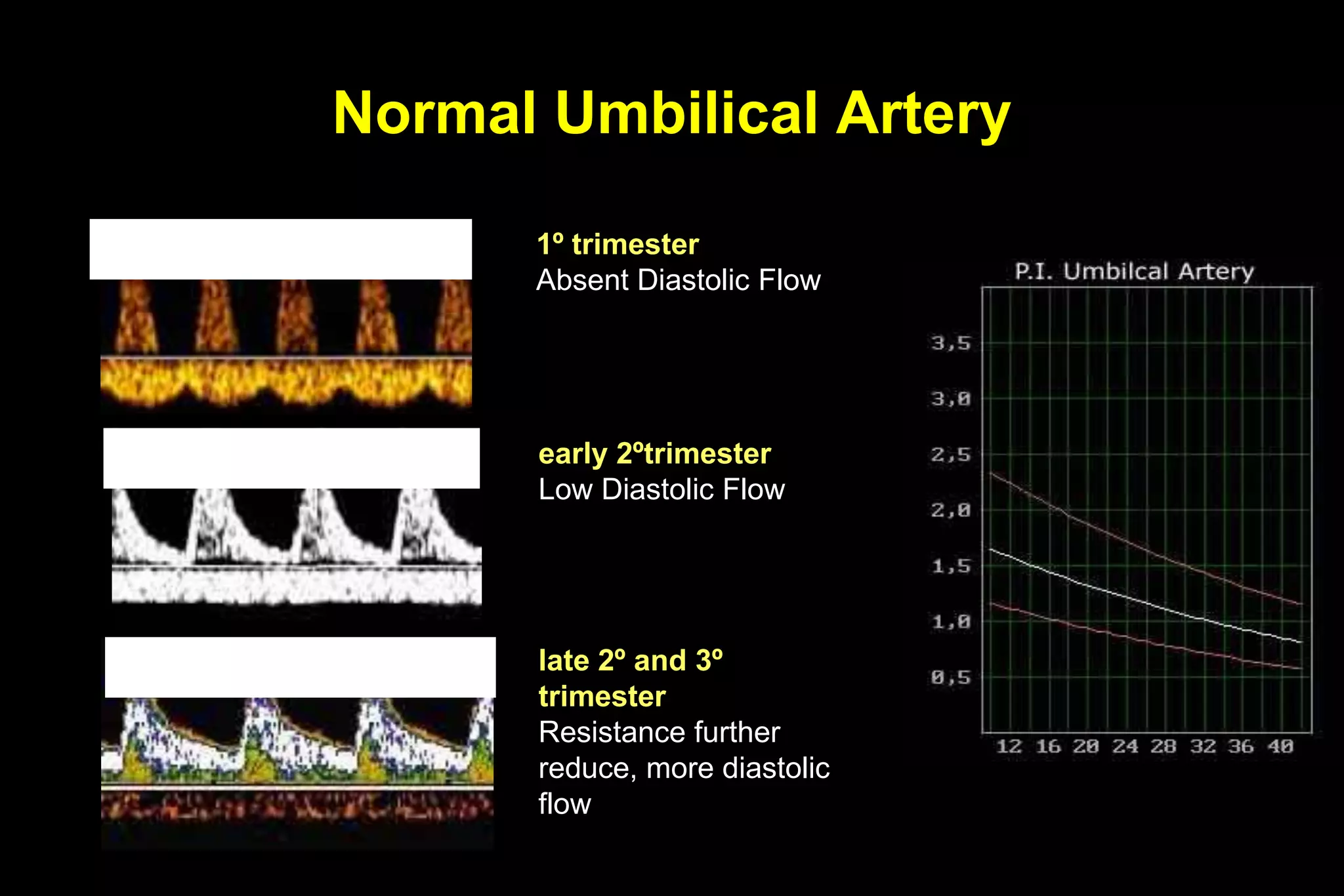 Color doppler in fetal hypoxia | PPTX