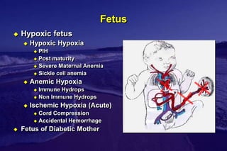 Color doppler in fetal hypoxia | PPTX