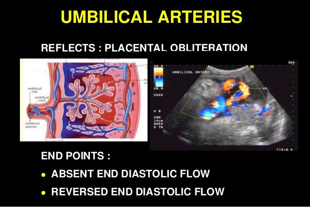 Color doppler in fetal hypoxia