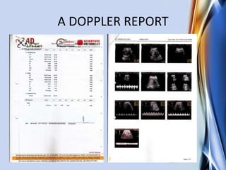 Color doppler in FGR making sence of waves | PPTX