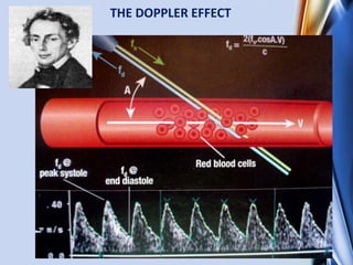 Color doppler in FGR making sence of waves | PPTX