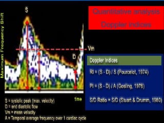 Color doppler in FGR making sence of waves | PPTX