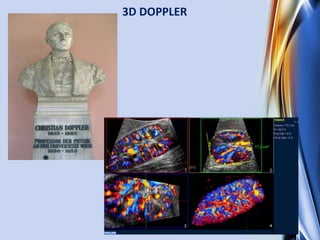 Color doppler in FGR making sence of waves | PPTX