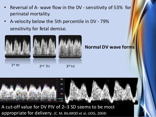 Color doppler in FGR making sence of waves