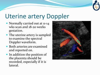 COLOR DOPPLER IN SURVEILLANCE OF PREGNANCY 1.pptx