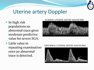 COLOR DOPPLER IN SURVEILLANCE OF PREGNANCY 1.pptx