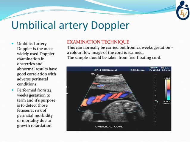 COLOR DOPPLER IN SURVEILLANCE OF PREGNANCY 1.pptx