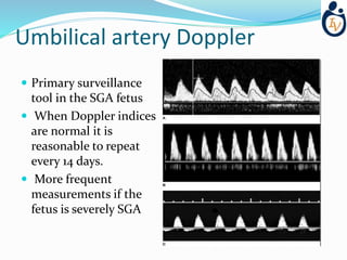COLOR DOPPLER IN SURVEILLANCE OF PREGNANCY 1.pptx