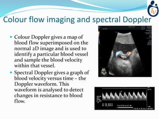 COLOR DOPPLER IN SURVEILLANCE OF PREGNANCY 1.pptx