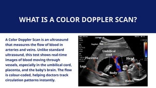 Color Doppler Scan in High-Risk Pregnancies Monitoring and Outcomes.pptx