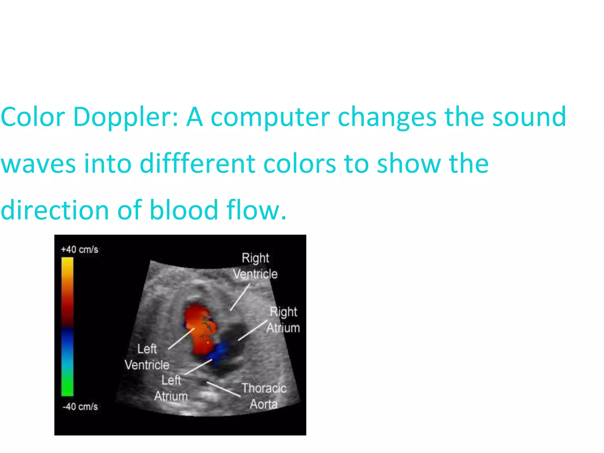 color doppler ultrasound .docx
