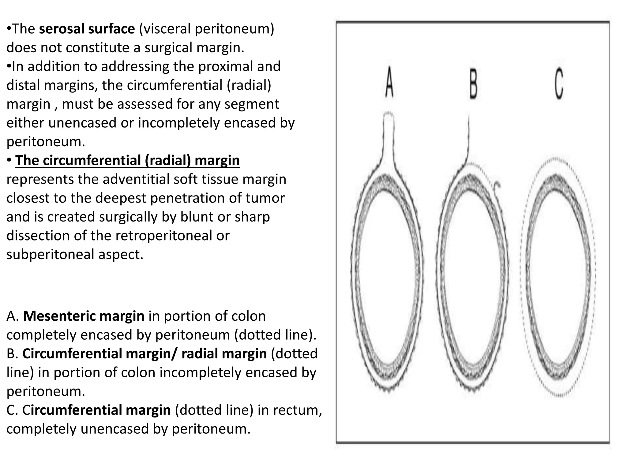 grossing of Colorectal specimens | PPTX