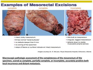 grossing of Colorectal specimens | PPTX