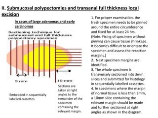 grossing of Colorectal specimens | PPTX