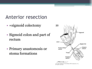 Colorectal surgery and stomas | PPT