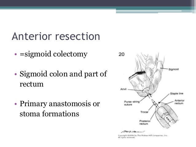 Colorectal surgery and stomas