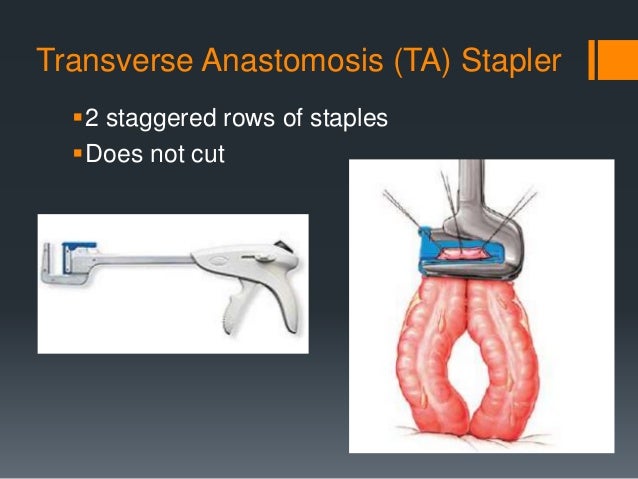Colorectal anastomosis