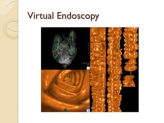 Colorectal Cancer | PDF