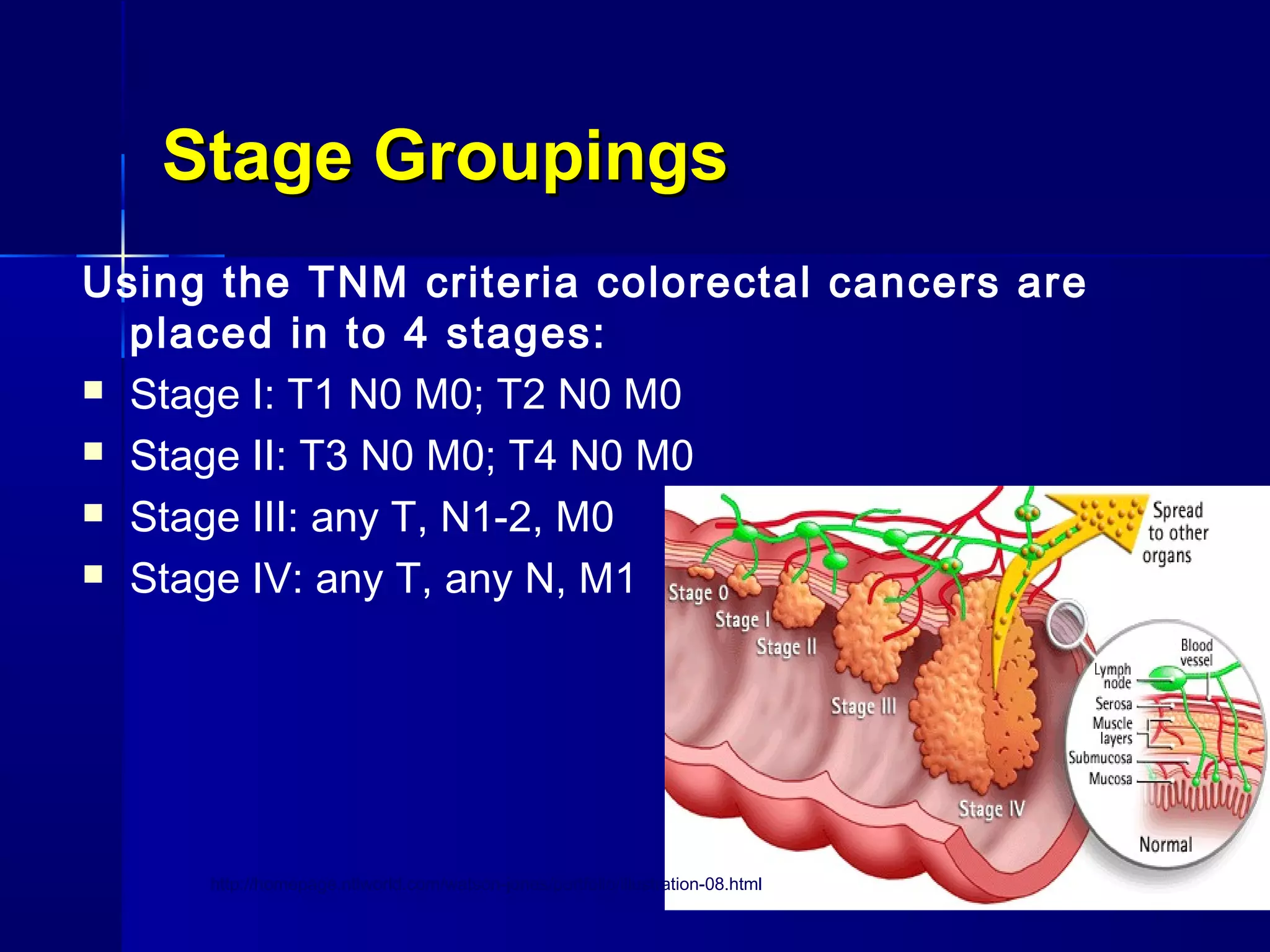 Colorectal cancer | PPT