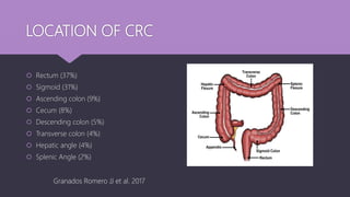 Colorectal cancer/ Kanker Kolorektal | PPTX